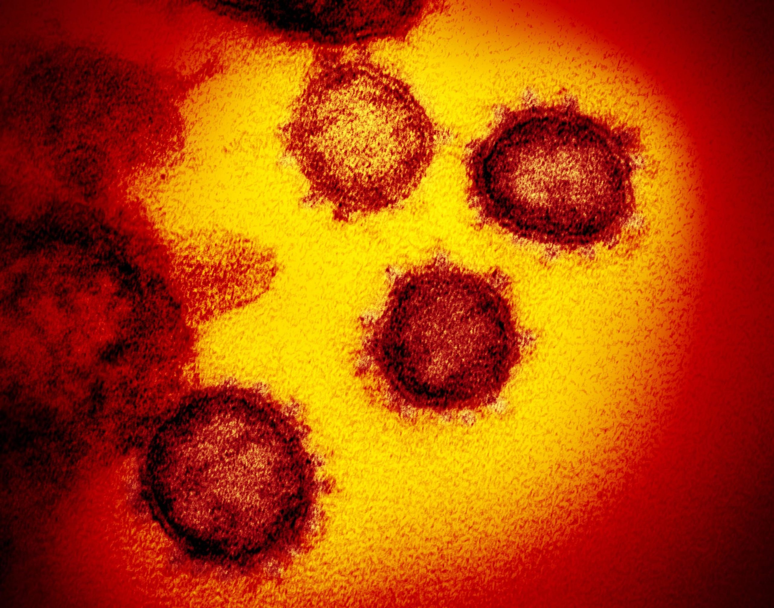Information on the Coronavirus for Patients and Visitors - South ...
